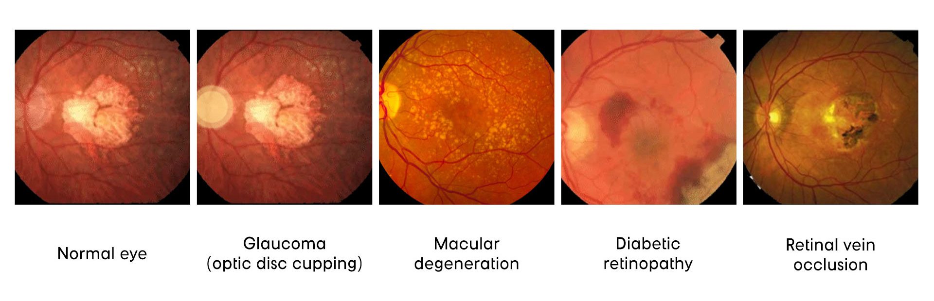 Ophthalmology and Eye Care Services | Shinagawa Diagnostic & Preventive ...
